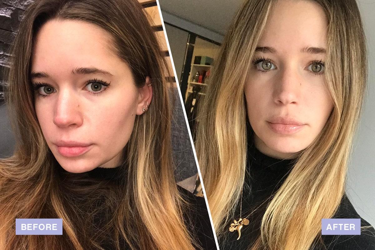 Iv Drip Benefits for Skin - the BEAUTIOUS